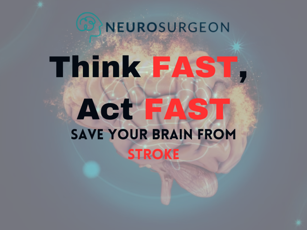 Think FAST, Act FAST, and Save Your Brain From Brain Stroke
